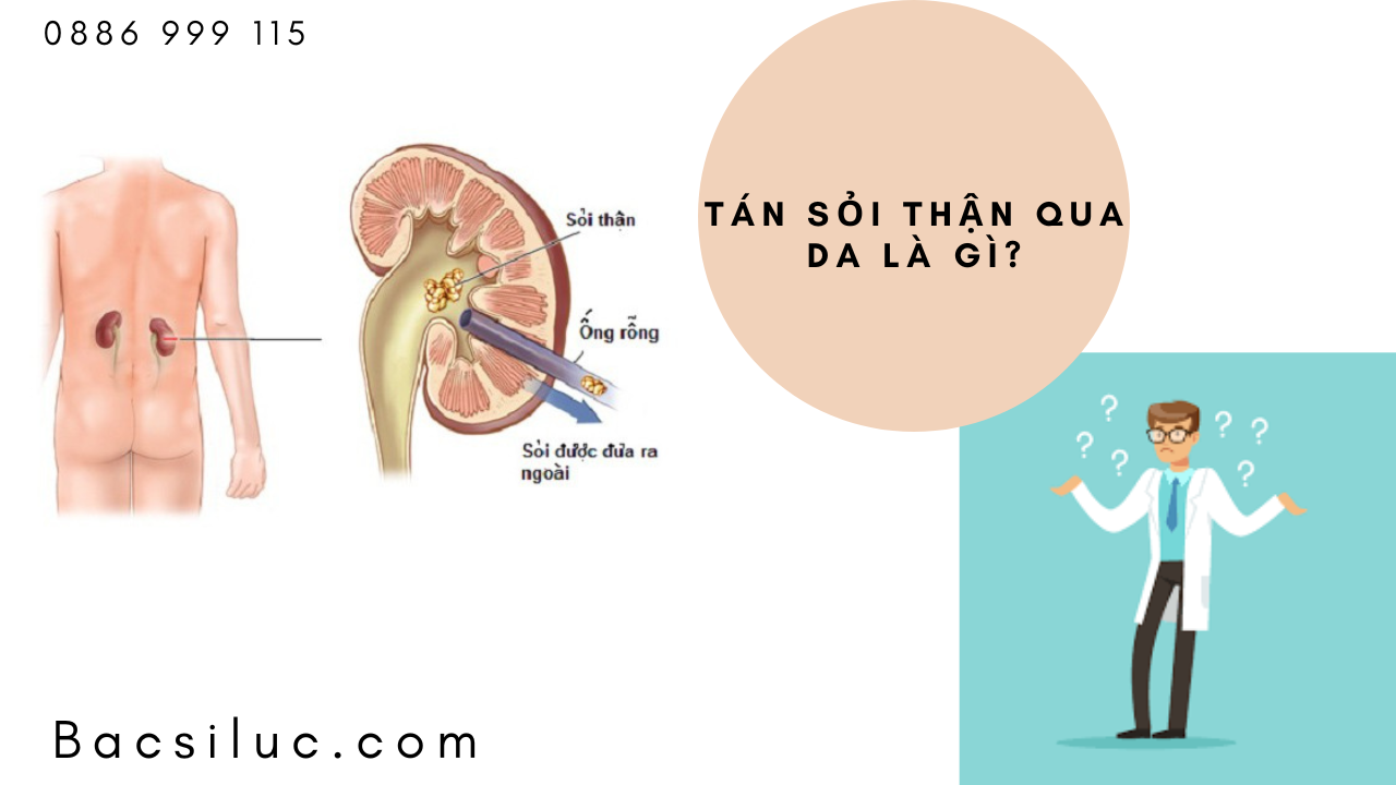 Tán sỏi thận qua da bằng đường hầm nhỏ - Bác sĩ Mai Văn Lực